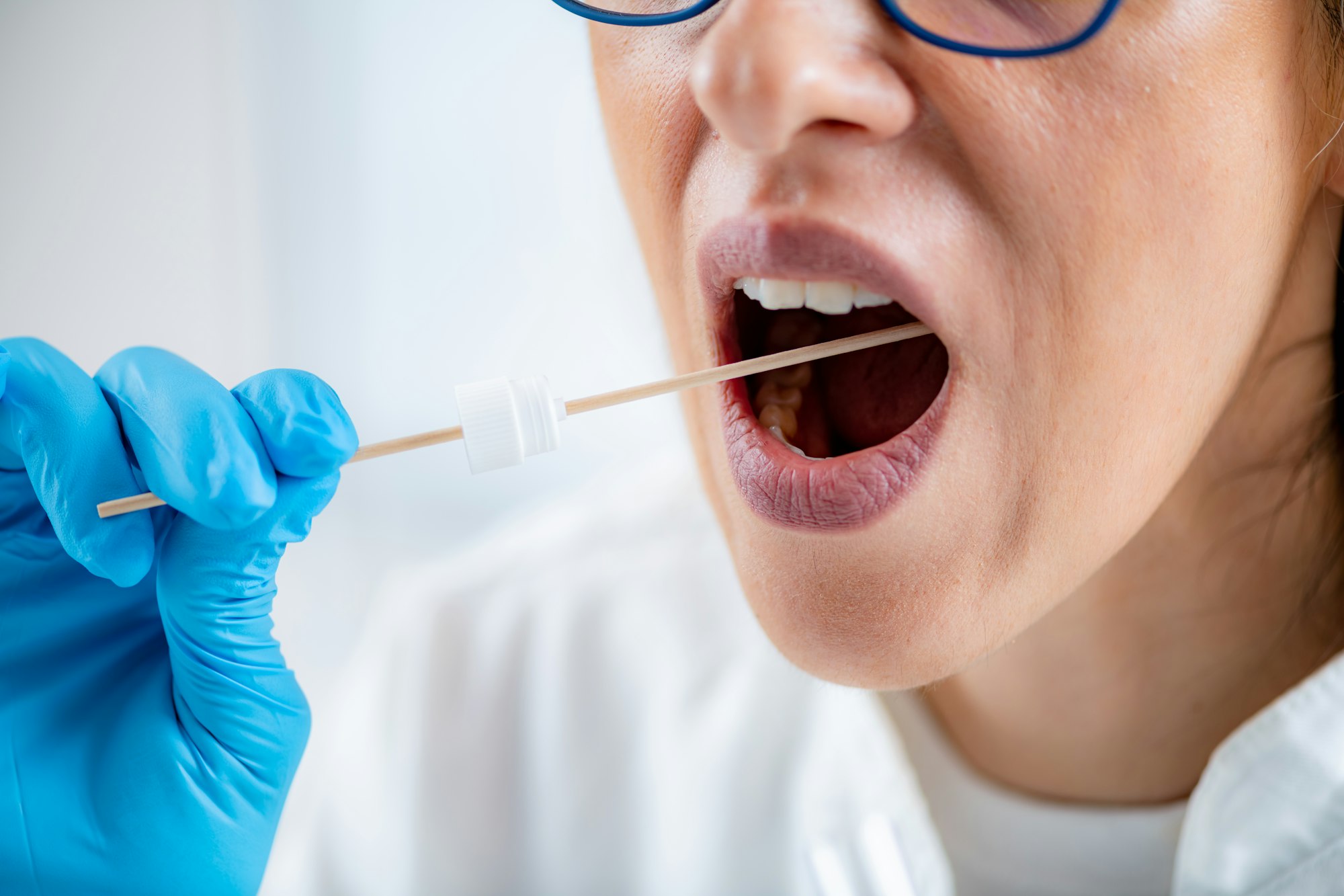 Taking a mouth swab for DNA analysis – Dr. Beth Good & Associates